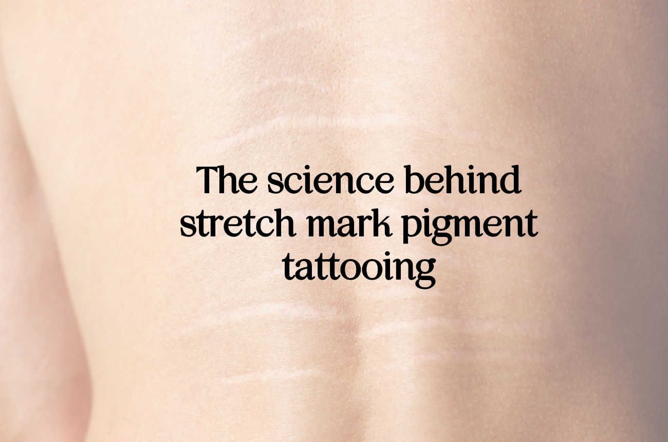 The science behind stretch mark pigment tattooing: How it works and wh – NUE Professional