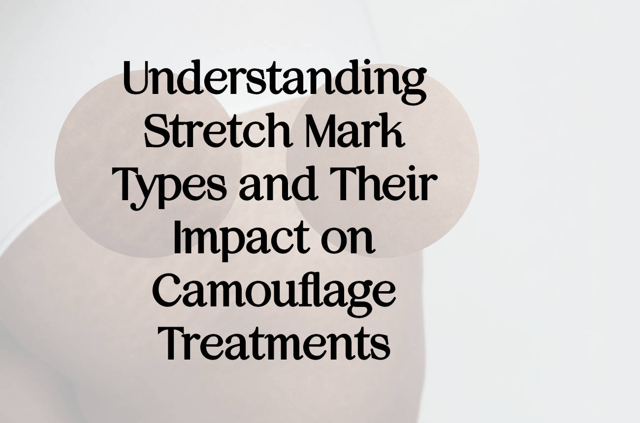 Understanding stretch mark types and their impact on camouflage treatm ...