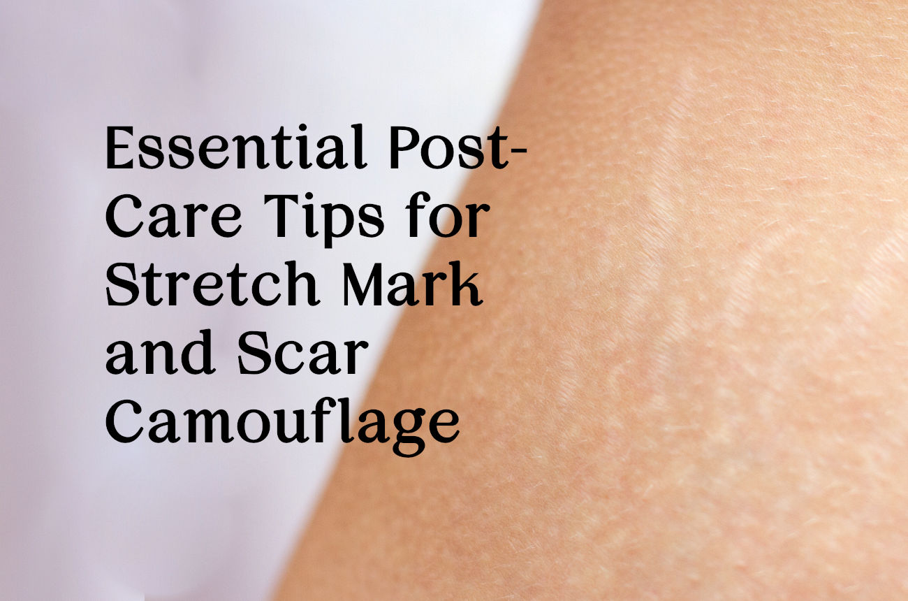 Post-Care for Camouflage Procedures – NUE Professional