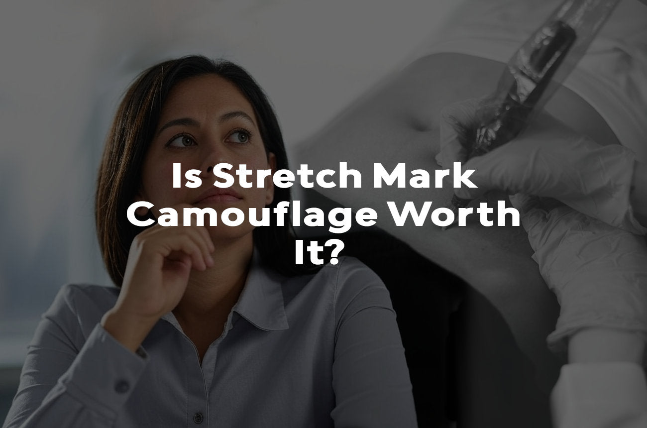 Is Stretch Mark Camouflage Worth It? The Benefits, Considerations, and – NUE Professional