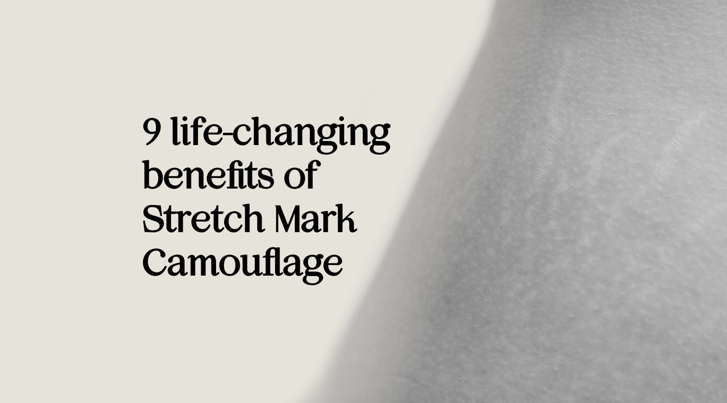 Benefits of Stretch Mark Camouflage – NUE Professional